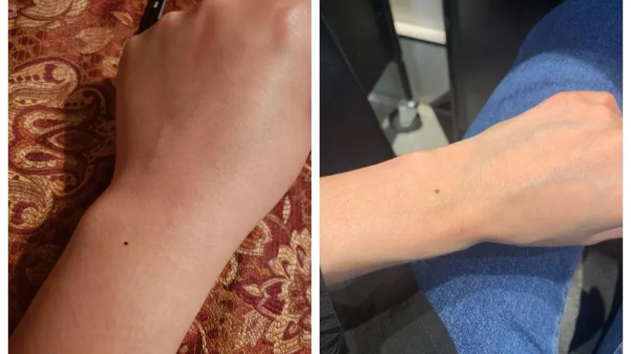 'Čarobna pjega': Navodno sve žene imaju isti madež na ruci, jesi li ...